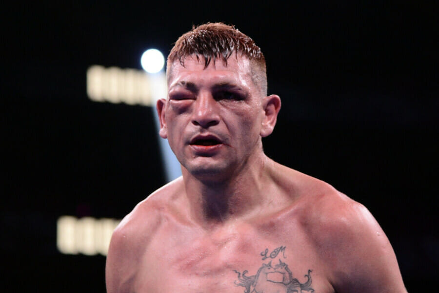 Boxer Edgar Berlanga Wins Match Despite Attempt to Bite Opponent's Ear ...